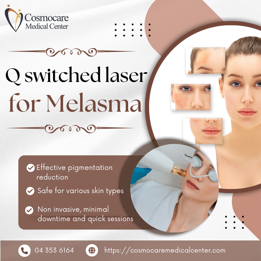 Q SWITCHED LASER FOR MELASMA - Cosmocare Medical Center