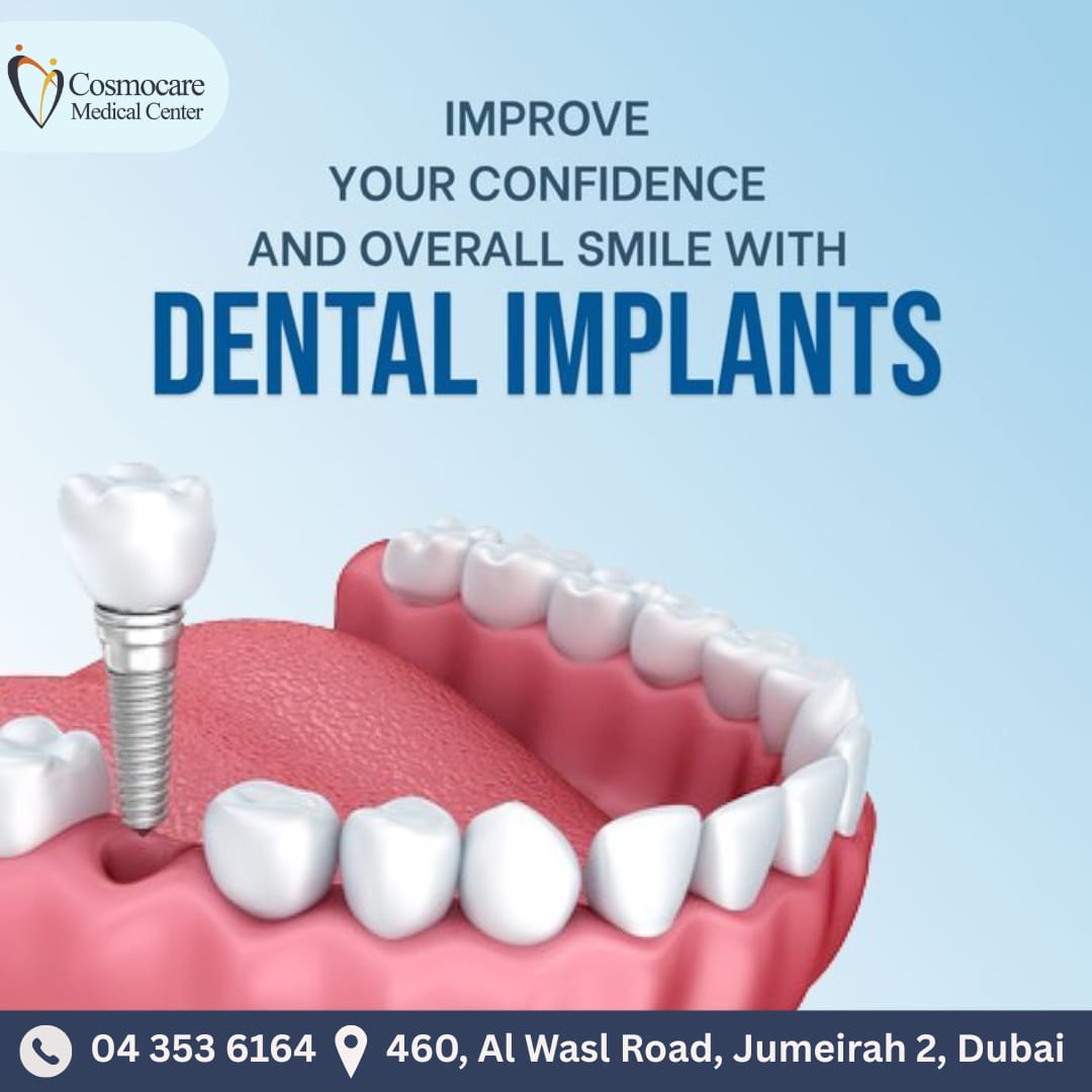 3000AED (Starting From) Per Tooth Dental Implants - Cosmocare Medical ...