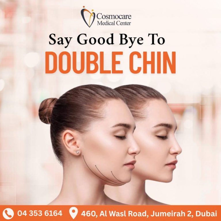 Say Goodbye to Double Chin! - Cosmocare Medical Center
