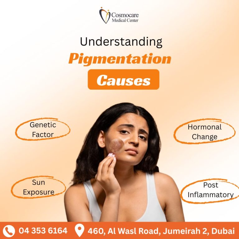 Understanding Pigmentation Causes - Cosmocare Medical Center